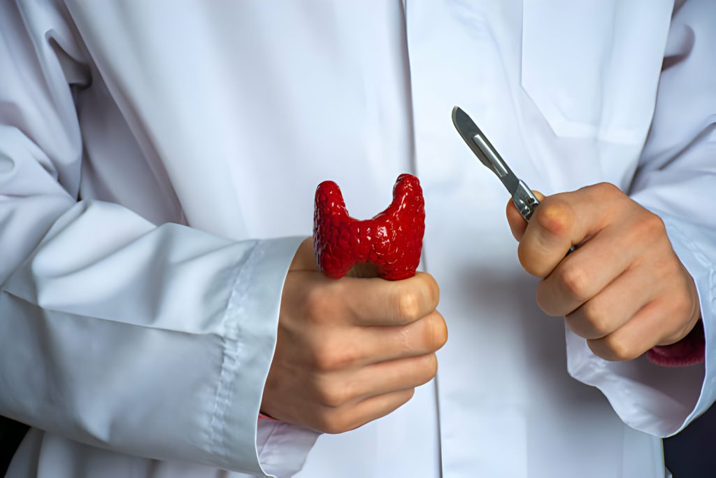 Goiter Surgery: Understanding an Enlarged Thyroid